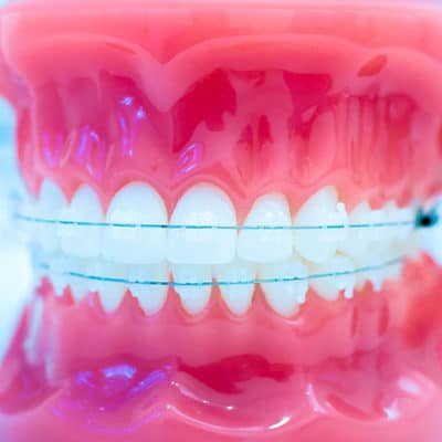 Korne Ortho | Braces | Orthodontist in Montreal